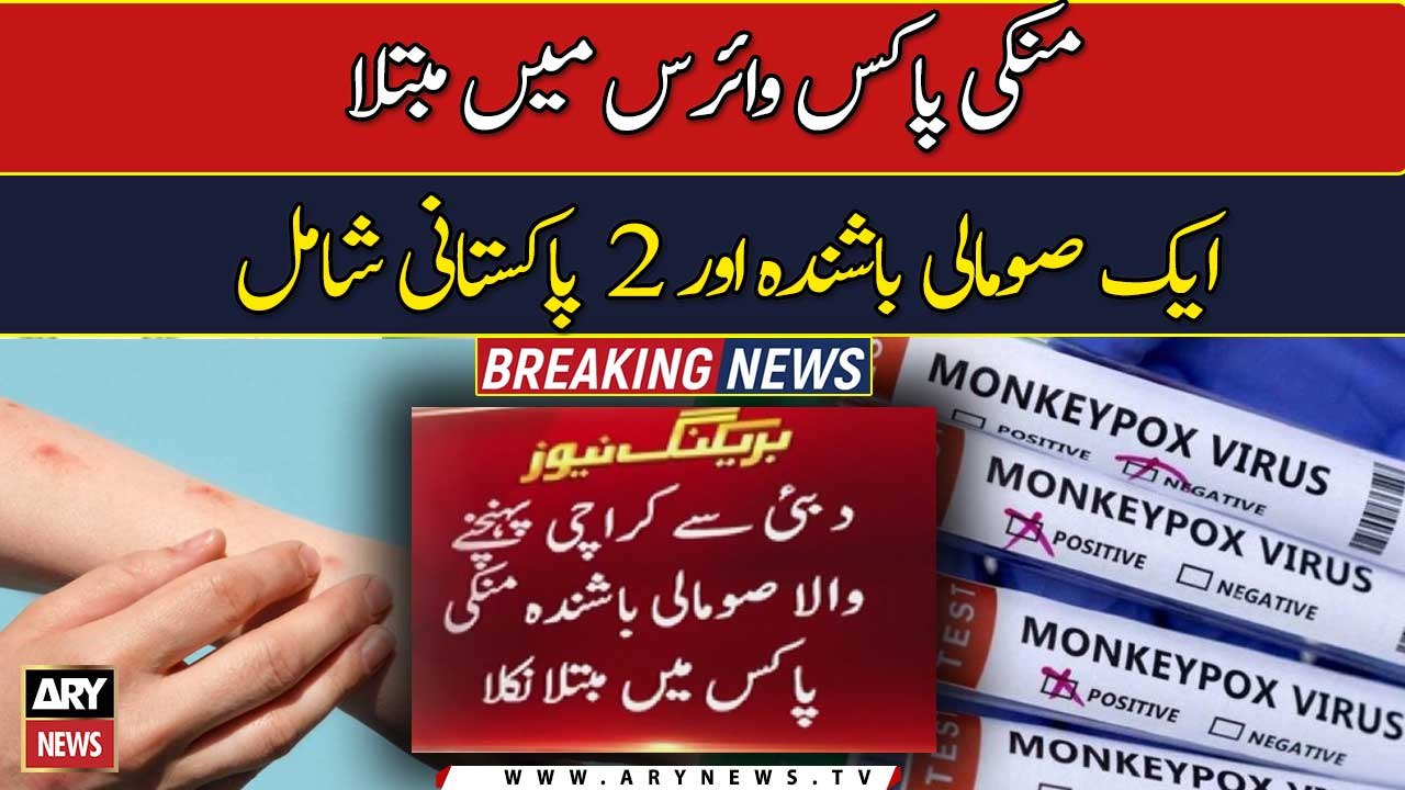 Three monkeypox cases detected in Karachi - video Dailymotion