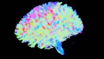 BBC Documentary - How You Really Make Decisions - BBC Horizon - Video ...