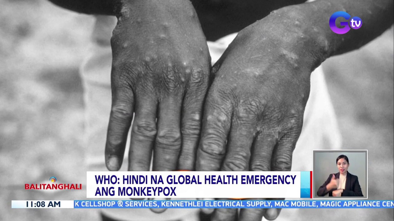 Hindi na global health emergency ang monkeypox — WHO | BT - video Dailymotion