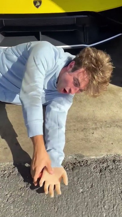 FAKE HAND PRANK - #shorts - video Dailymotion