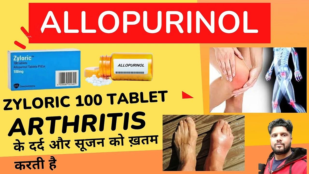 ZYLORIC 100 | ALLOPURINOL | ARTHRITIS PAIN | दर्द और सूजन से राहत | USE ...