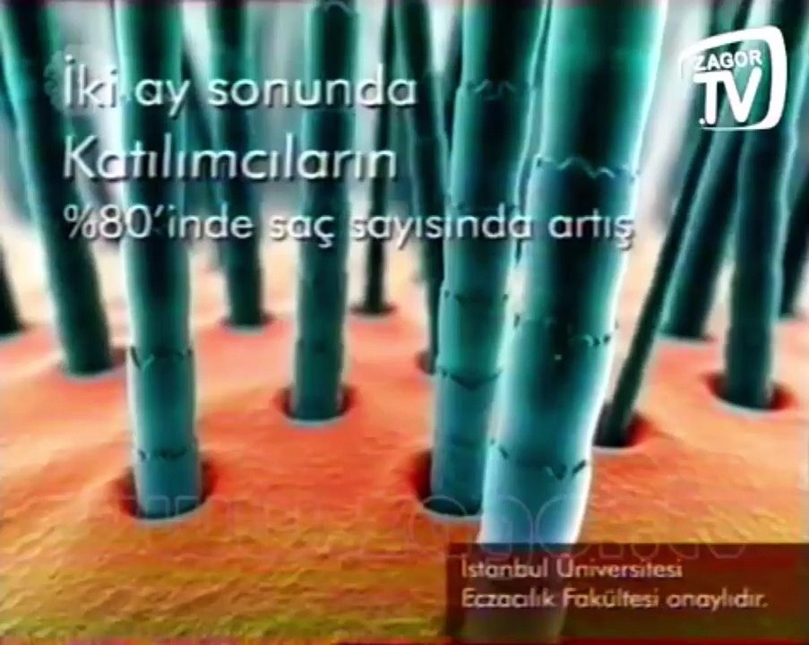 Show TV Reklam Kuşağı - Ocak 2007 - Dailymotion Video