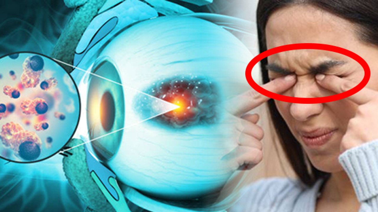 Eye Itching होना Eye Herpes Symptoms, क्या है Reason और कैसे लें ...