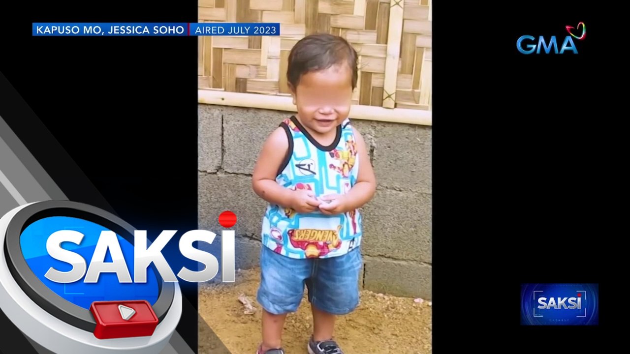 3-anyos na batang nahulog sa lutuan ng uling noong Hulyo, binawian na ...