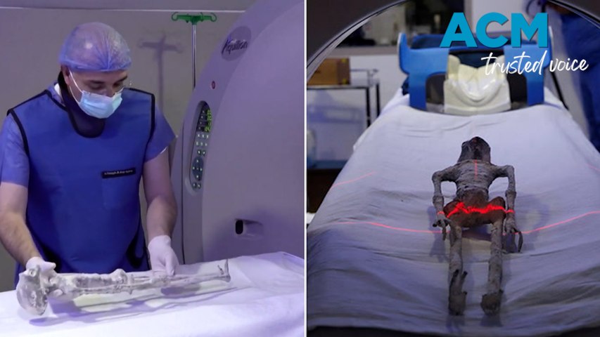 'Alien' remains undergo CT scan, revealing body with eggs. | Central ...