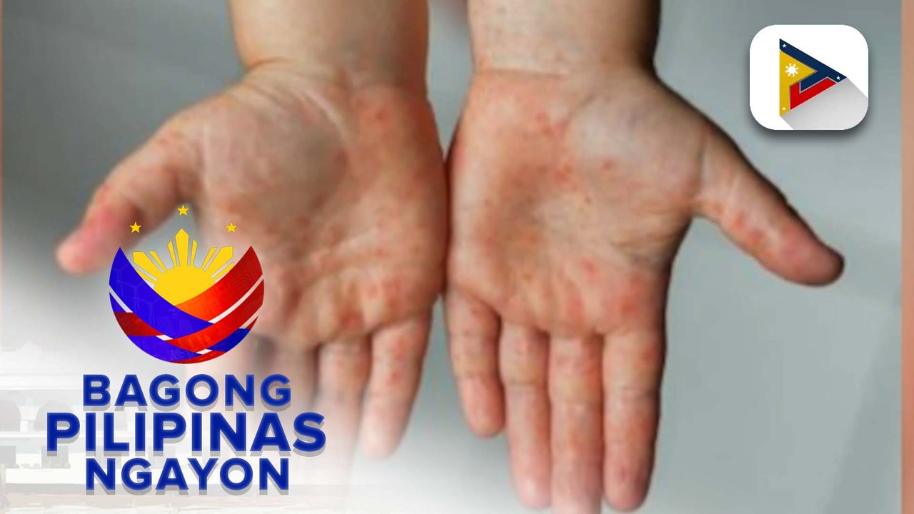 Panayam kay infectious diseases expert Dr. Rontgene Solante - video ...