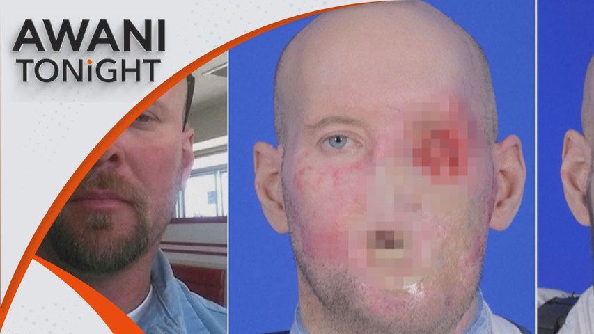 AWANI Tonight: Surgeons announce world’s first whole eye transplant ...