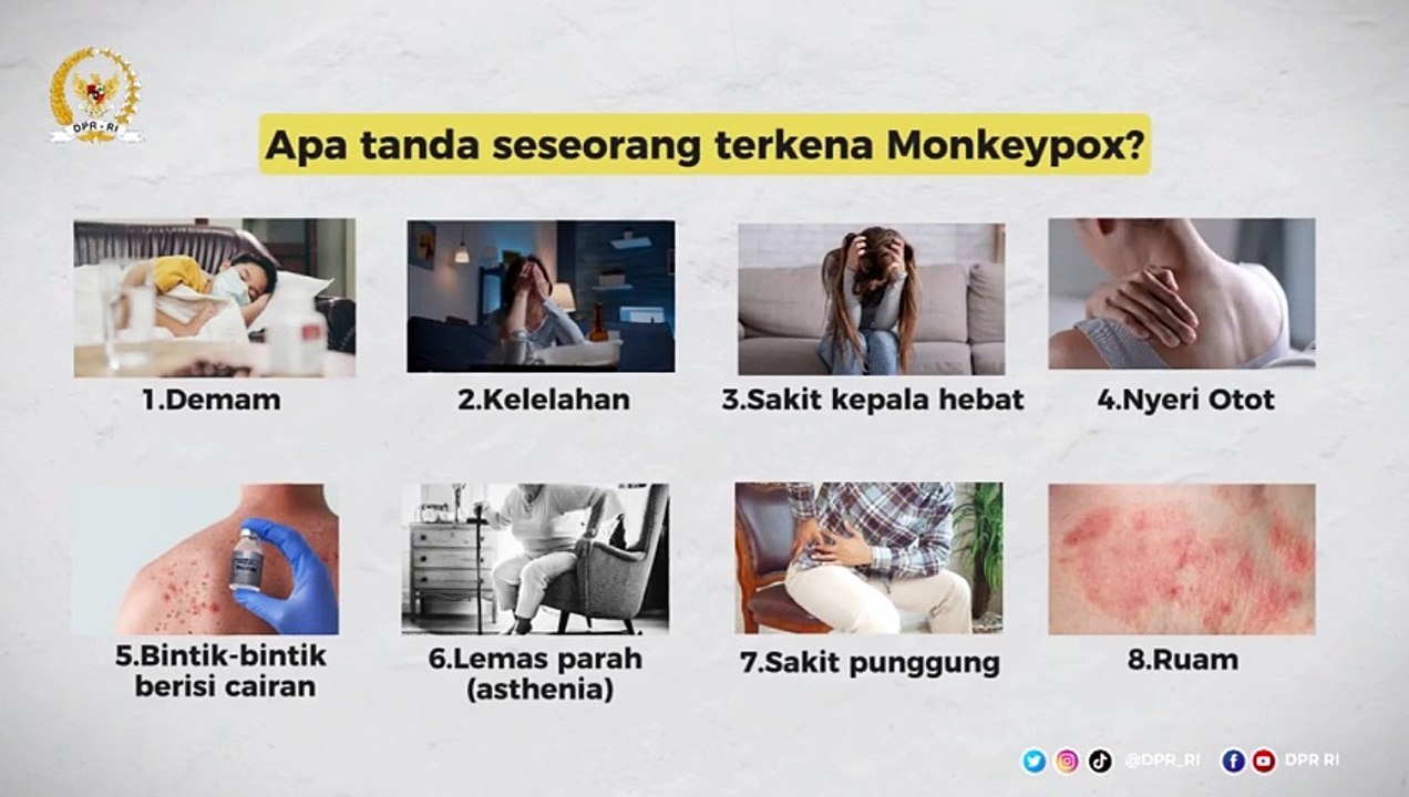 Waspadai Gejala dan Cara Penularan Virus Monkeypox - Video Dailymotion