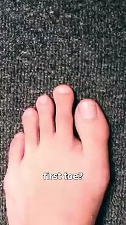 Do You Have A Long Second Toe？ - video Dailymotion