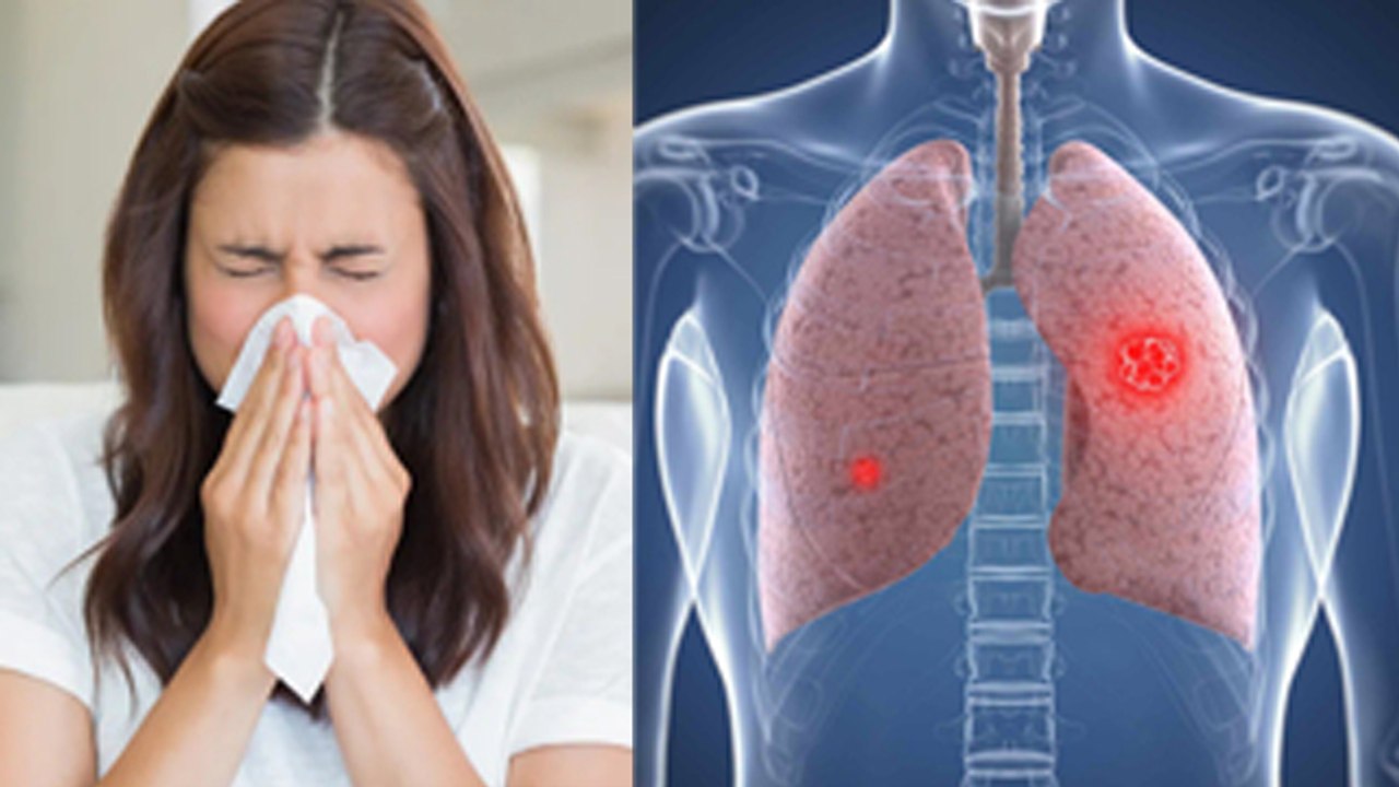 छींक रोकने से Lung Damage कैसे, Is Stopping Sneeze Bad For You|Stopping ...