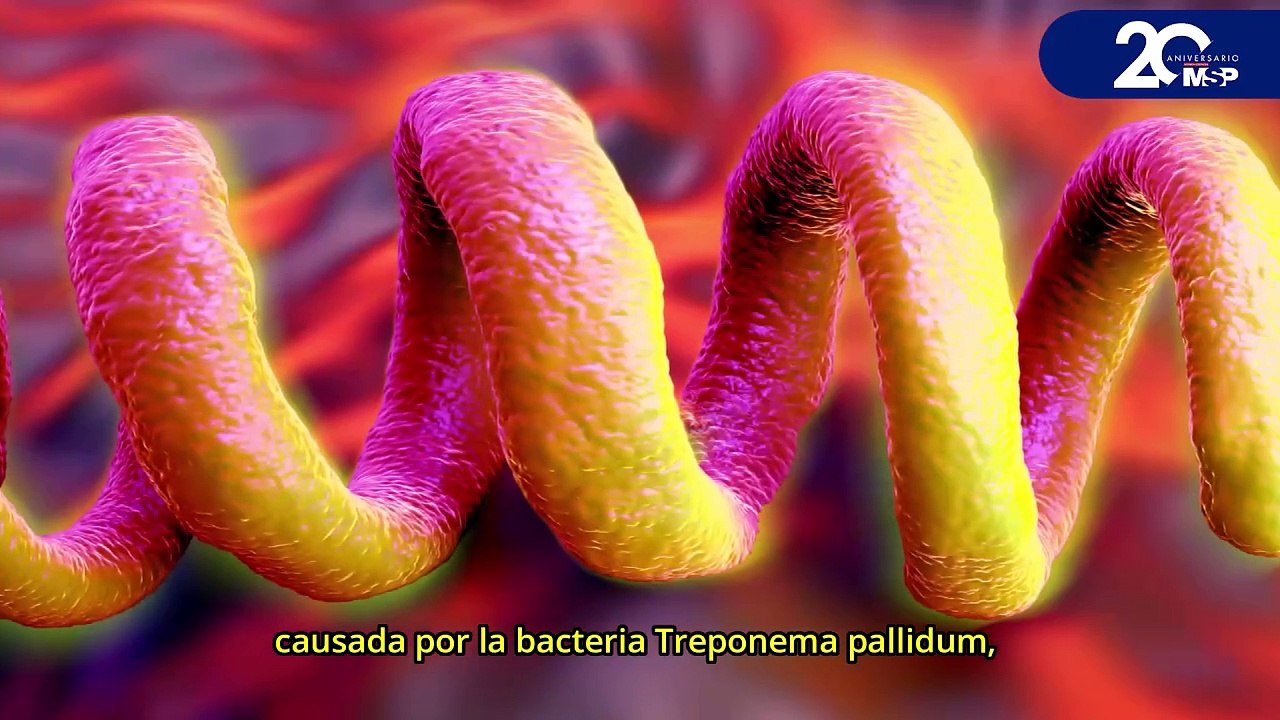 ¿Cómo funcionan las 3 etapas de la sífilis en el cuerpo? - # ...