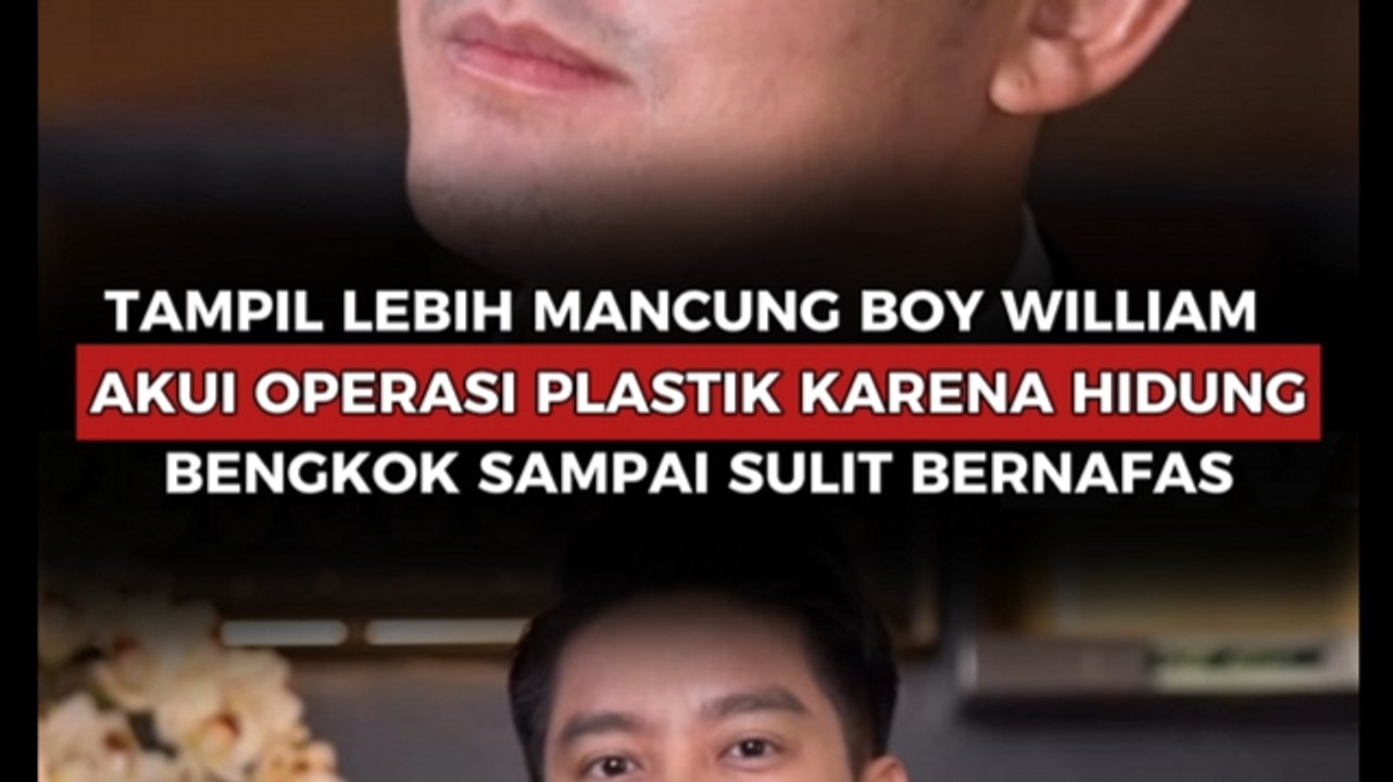 Tampil Lebih Mancung Boy William Akui Operasi Plastik Karena Hidung ...