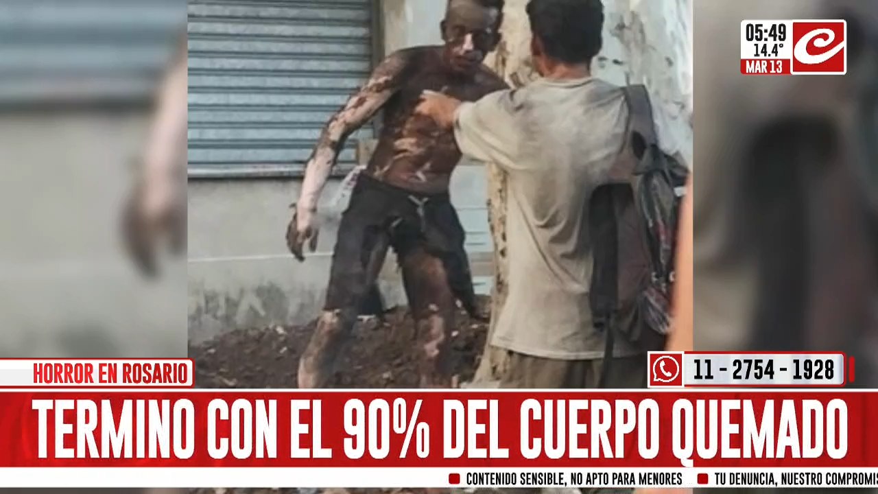 Intentó robar cables de alta tensión, se electrocutó y terminó con el ...