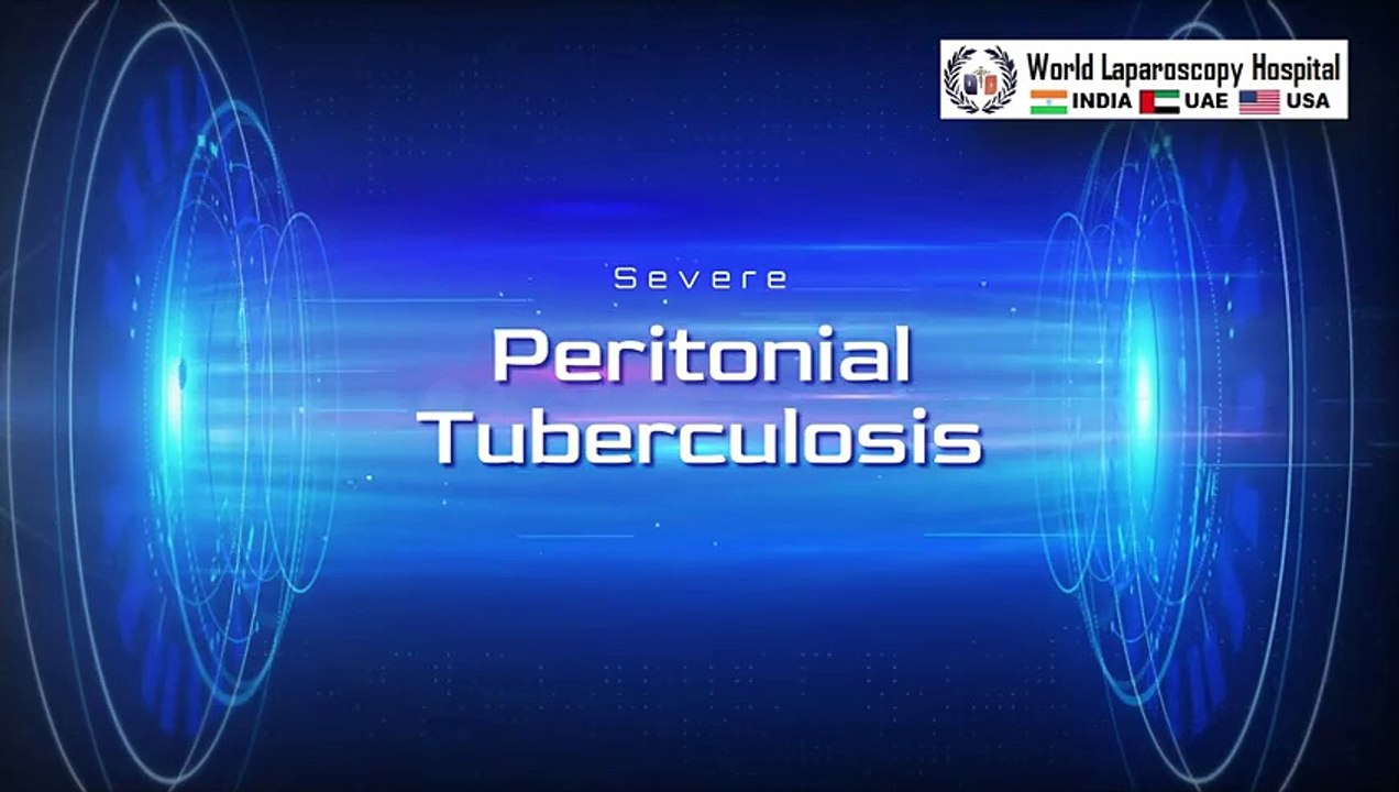 Laparoscopy in Peritoneal Tuberculosis A Revolutionary Diagnostic and ...