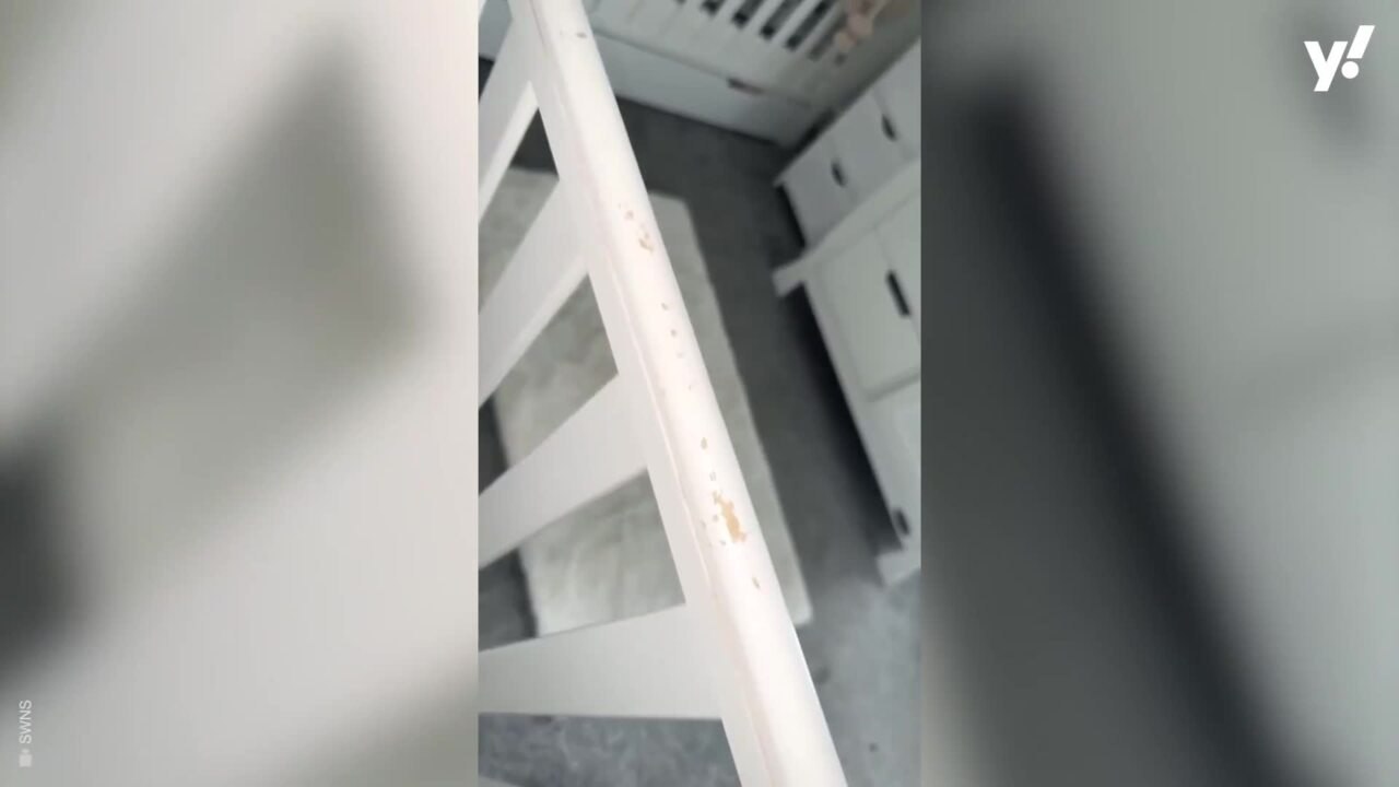 Mum shares how her daughter eats plaster, sofa foam and glass due to ...