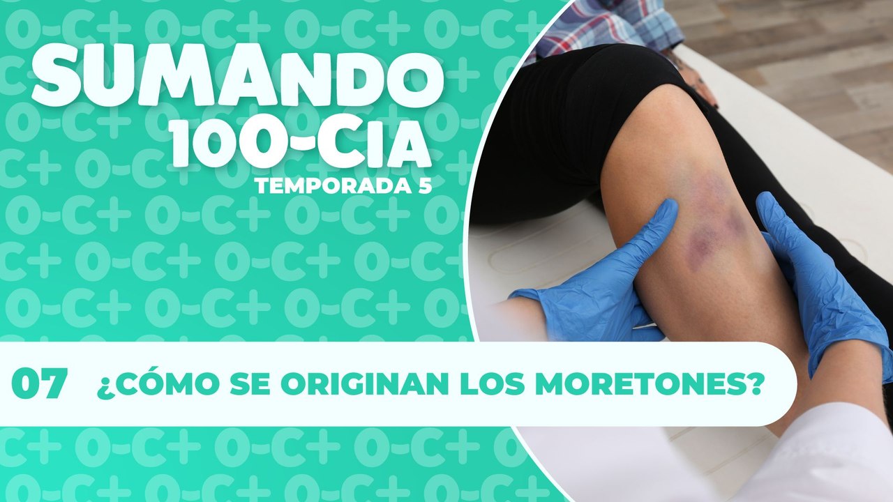 07 ¿CÓMO SE ORIGINAN LOS MORETONES? - Vídeo Dailymotion