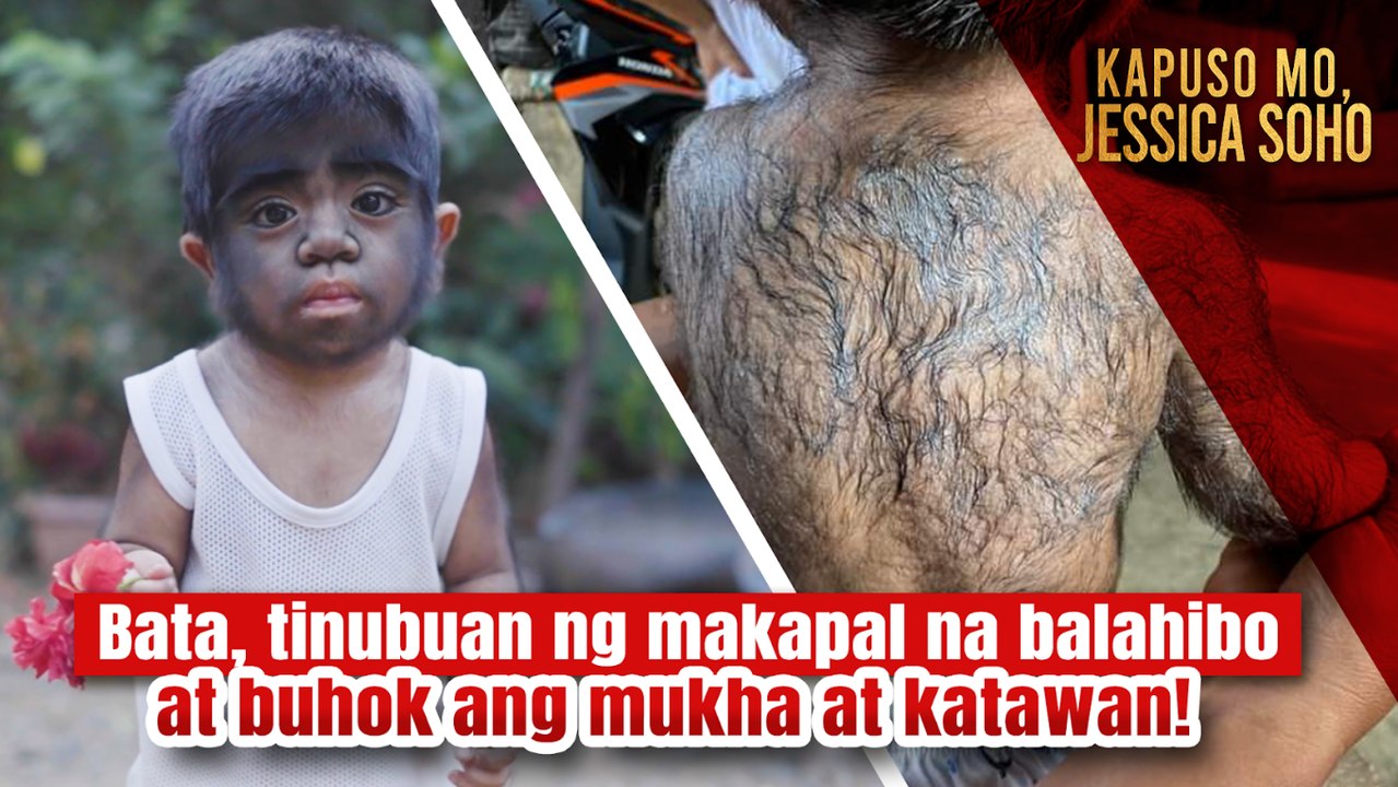 Bata, tinubuan ng makapal na balahibo at buhok ang mukha at katawan! | Kapuso Mo, Jessica Soho ...