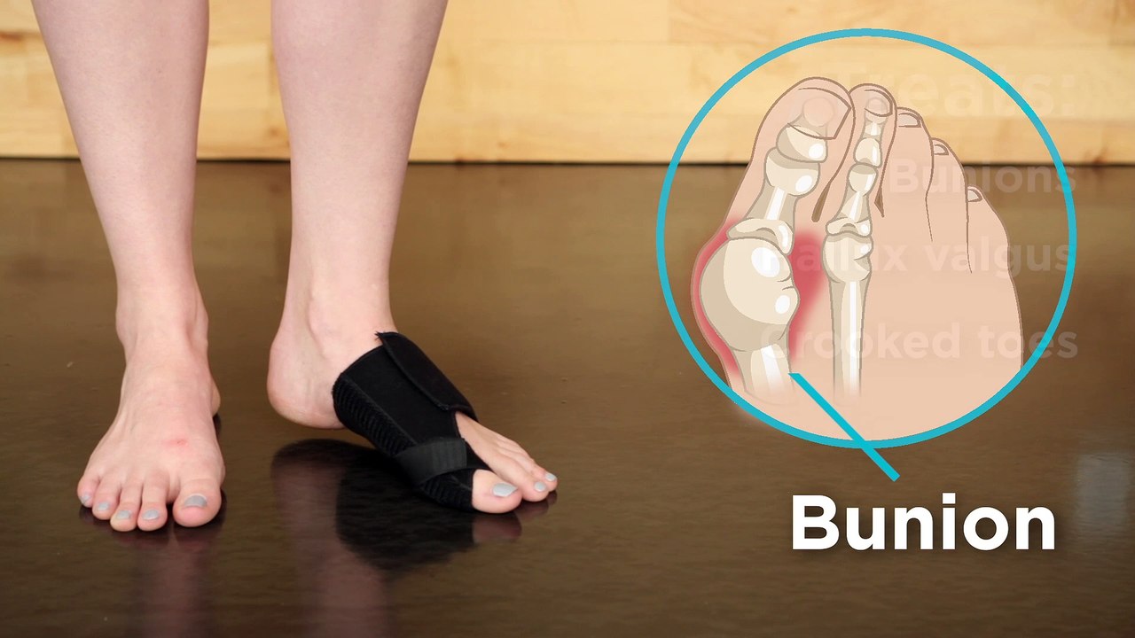 BraceAbility Bunion Corrector: How to Treat a Crooked Big Toe & Fix ...