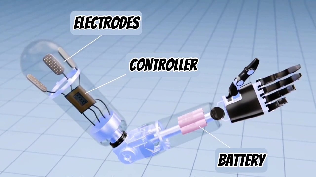 How Bionic Arm Works? Working of Robotic Arm Explained with 3D ...