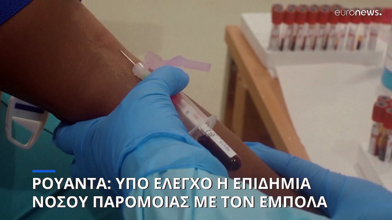 Ρουάντα: Υπό έλεγχο η επιδημία νόσου που μοιάζει με τον Εμπόλα ...