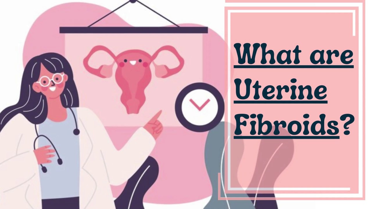 Uterine Fibroids "The Benign Cancer of Uterus" Explained Easy - video ...