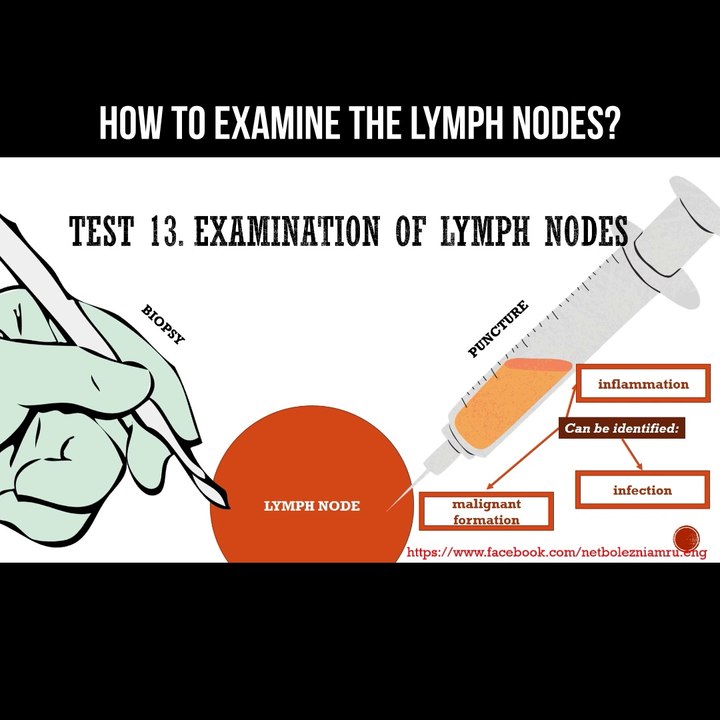 How to examine the lymph nodes? #lymphnodes #lymphology - video Dailymotion