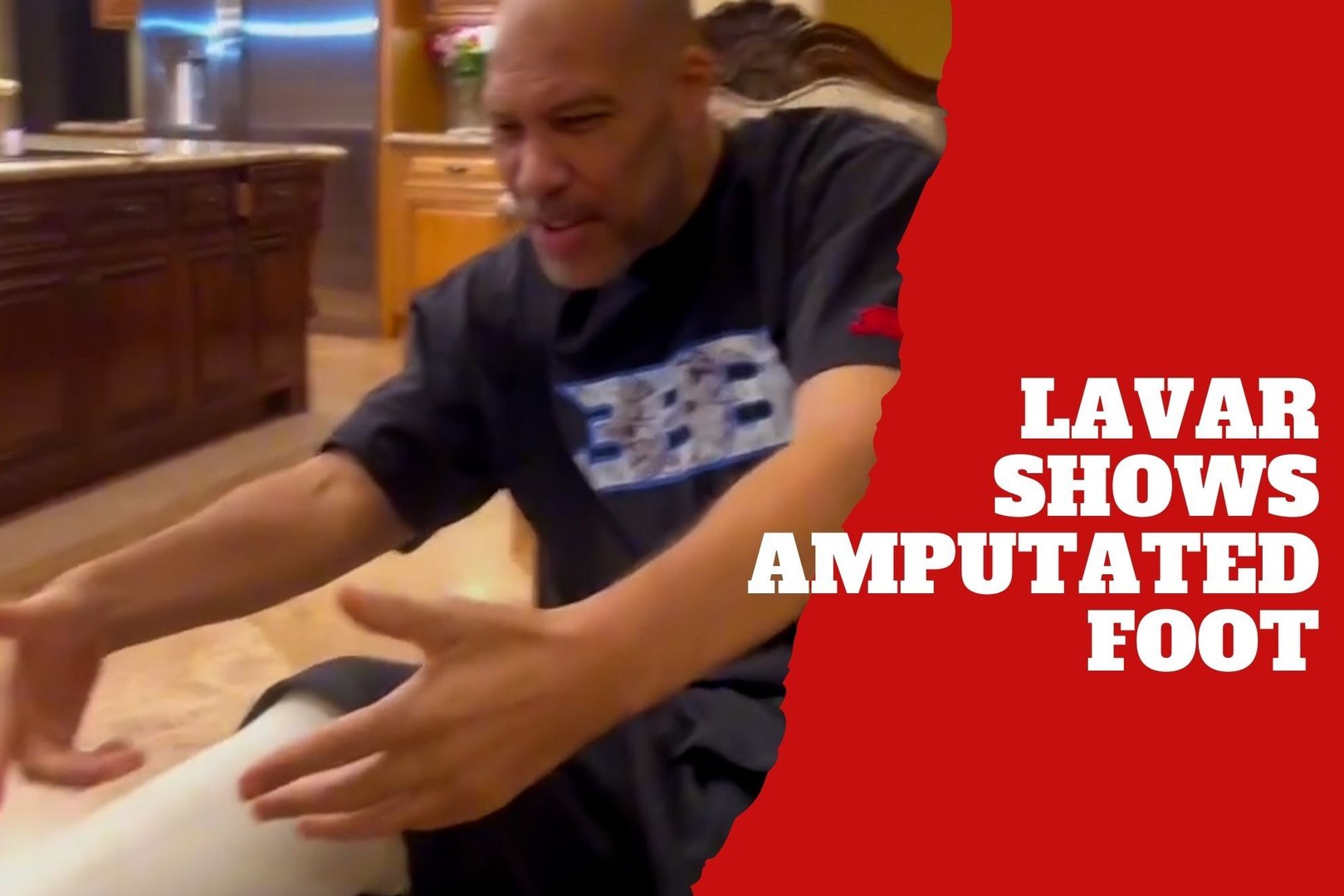 LaVar Ball?s unexpected reaction to leg amputation - MARCA TV English