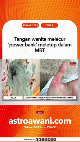 Tangan wanita melecur 'power bank' meletup dalam MRT | Astro Awani