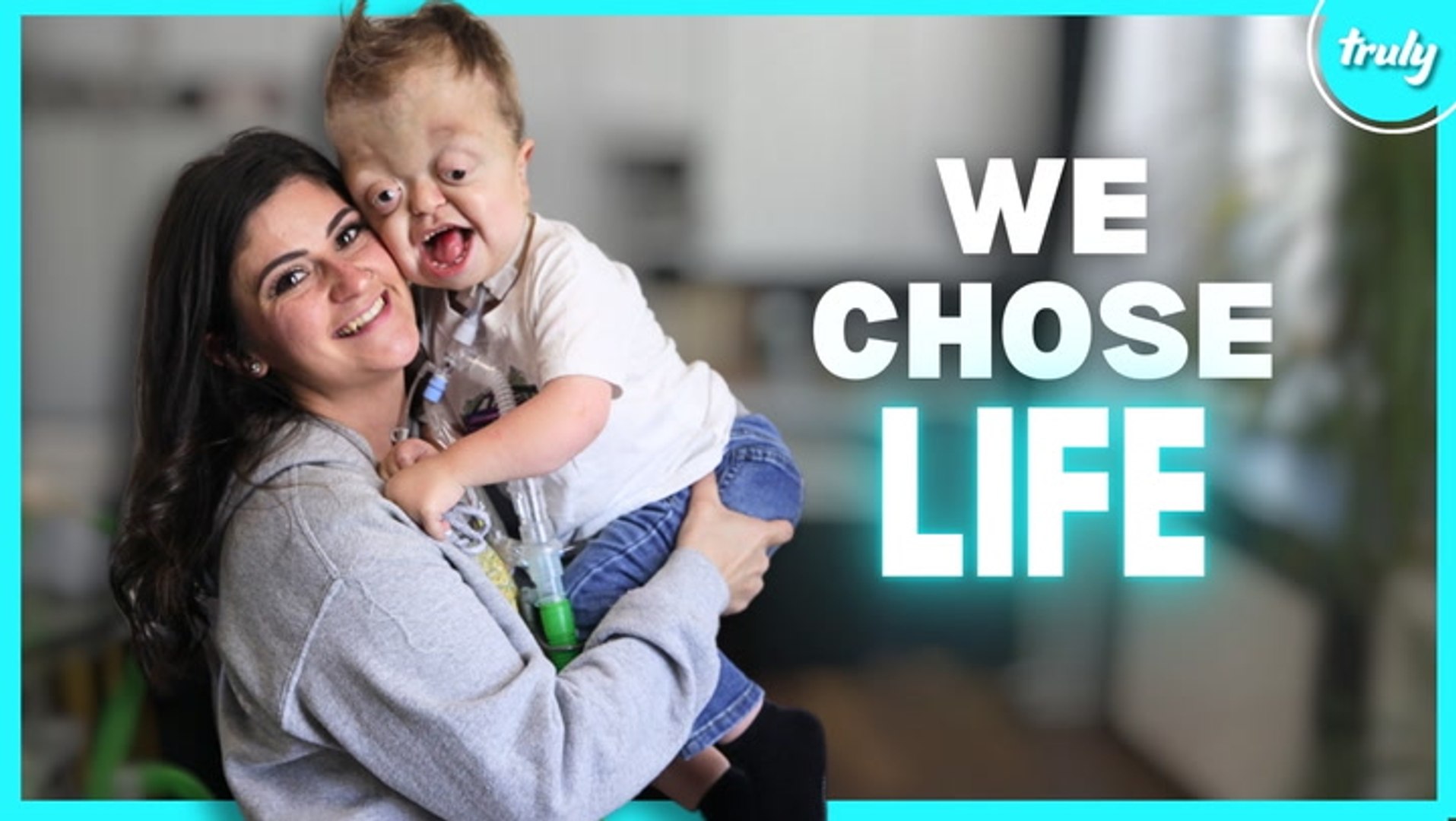 Pfeiffer Syndrome Kid Memes It's Hip To Be Rare. Happy Rare Disease