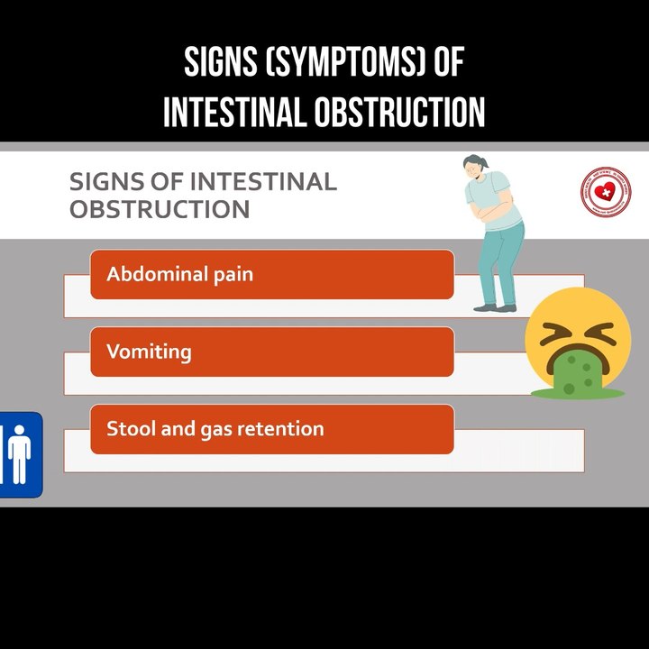 Signs (symptoms) of intestinal obstruction - video Dailymotion