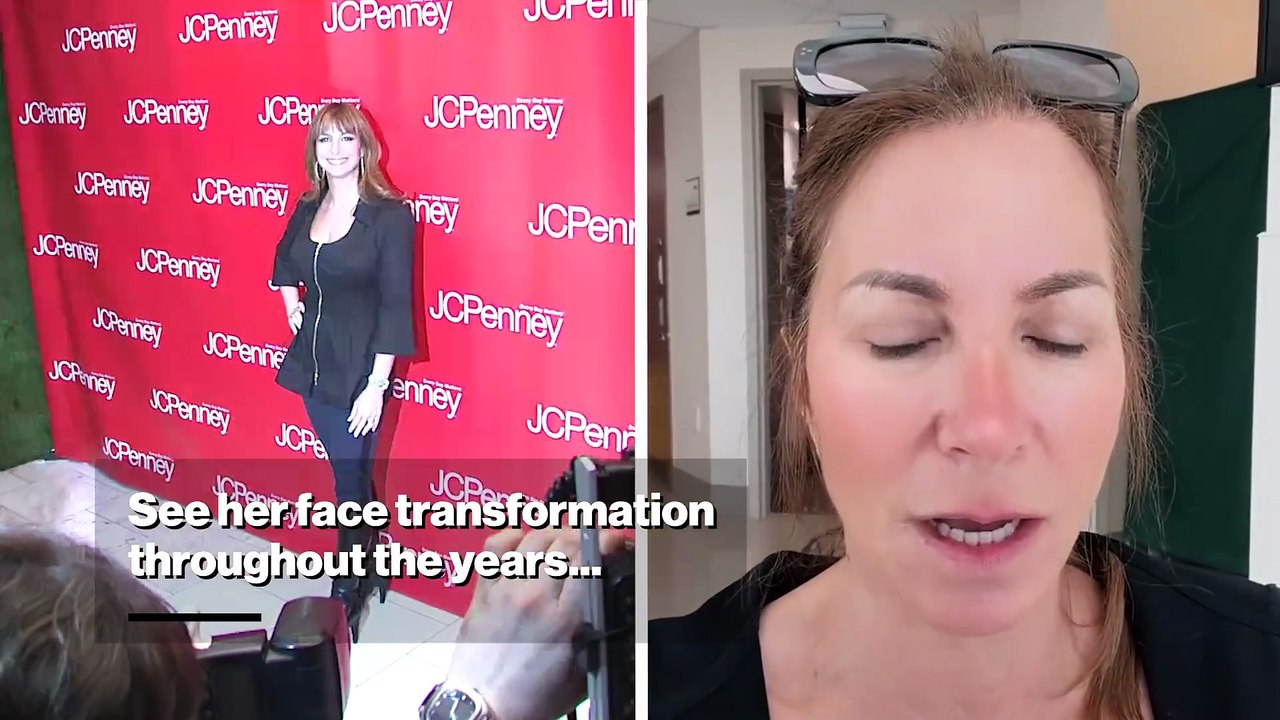 See 'RHONY' alum Jill Zarin's face transformation after being called ...