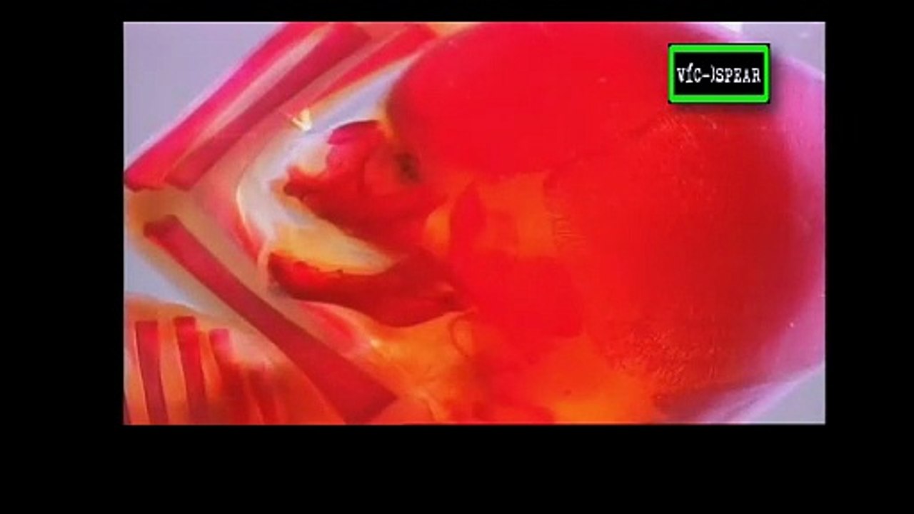 Atlas del Cuerpo: Humano Músculos y huesos - Documental (1994) Español ...